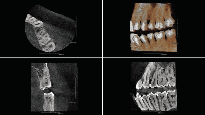 PreXion 3D Explorer (LP) - PreXion
