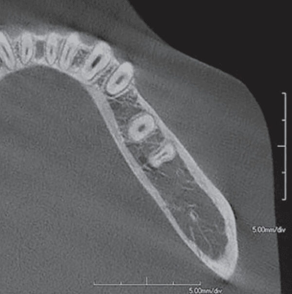 PreXion 3D Explorer (LP) - PreXion