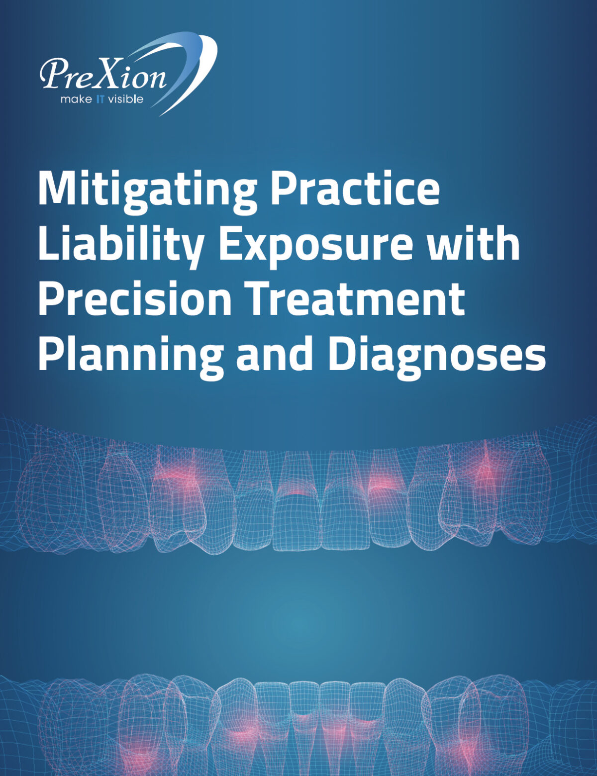 Downloadable Assets - PreXion