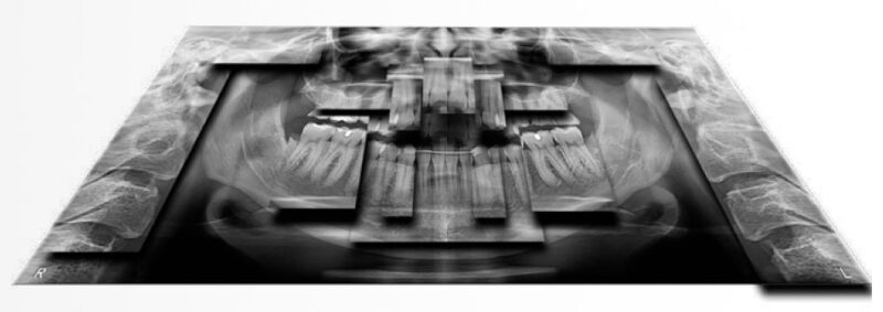 PreXion CBCT Scanner PreXion 3D Evolve | PreXion