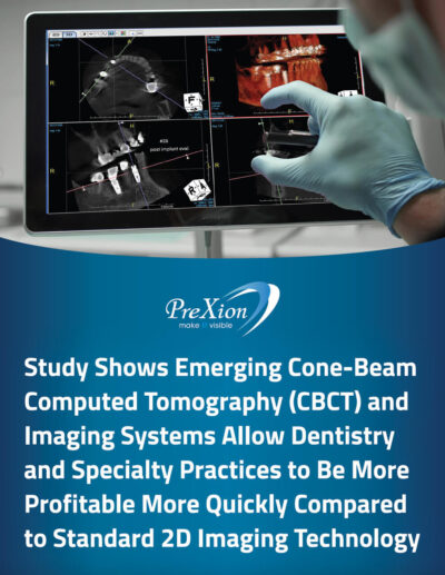 Explorer EX CBCT Scanner - PreXion