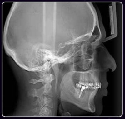 Evolve 2D (PAN) - PreXion